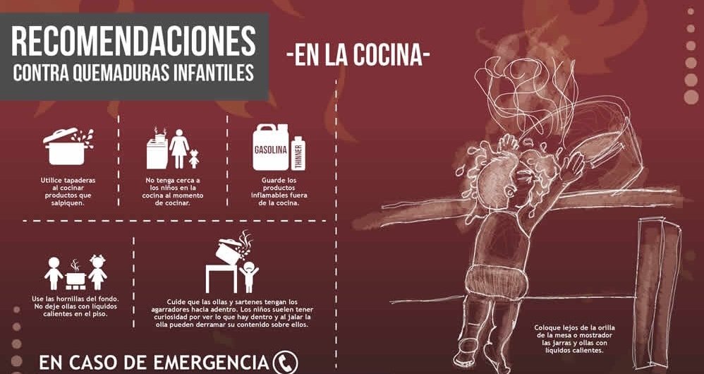 Ideas Para Prevenir Quemaduras En Casa - Candi Amor